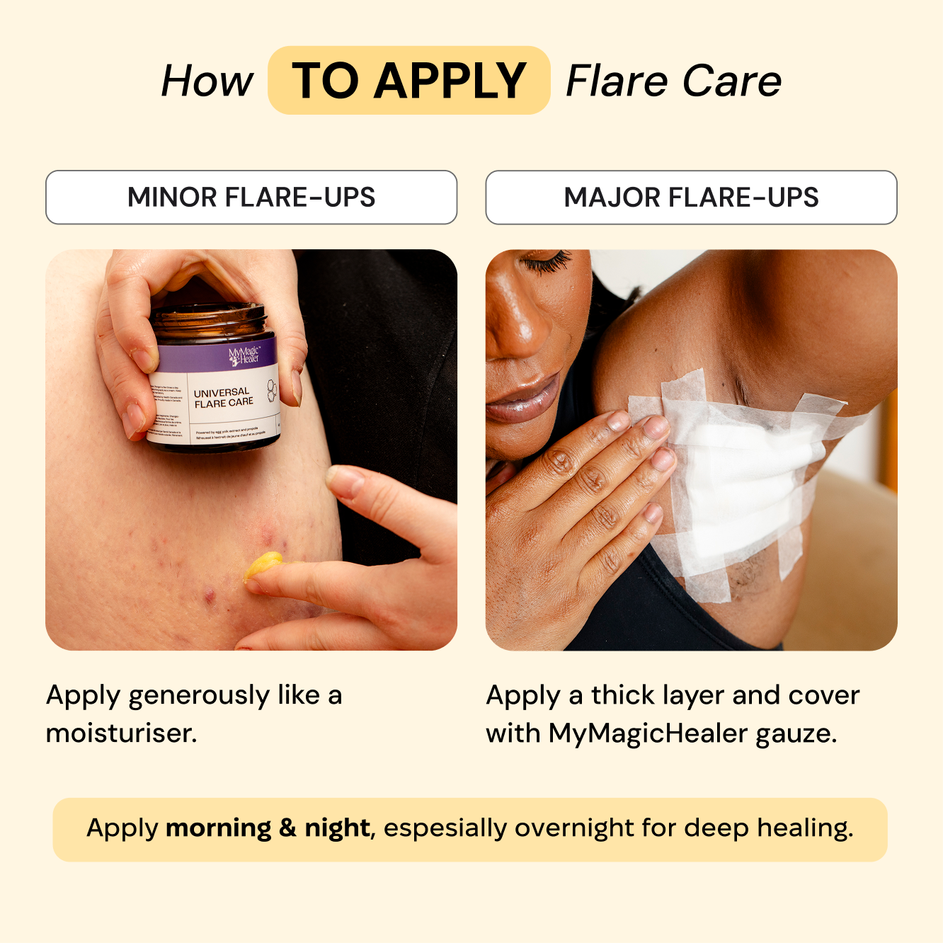 HS, Impetigo, Abscesses & Boils Solution | MyMagicHealer