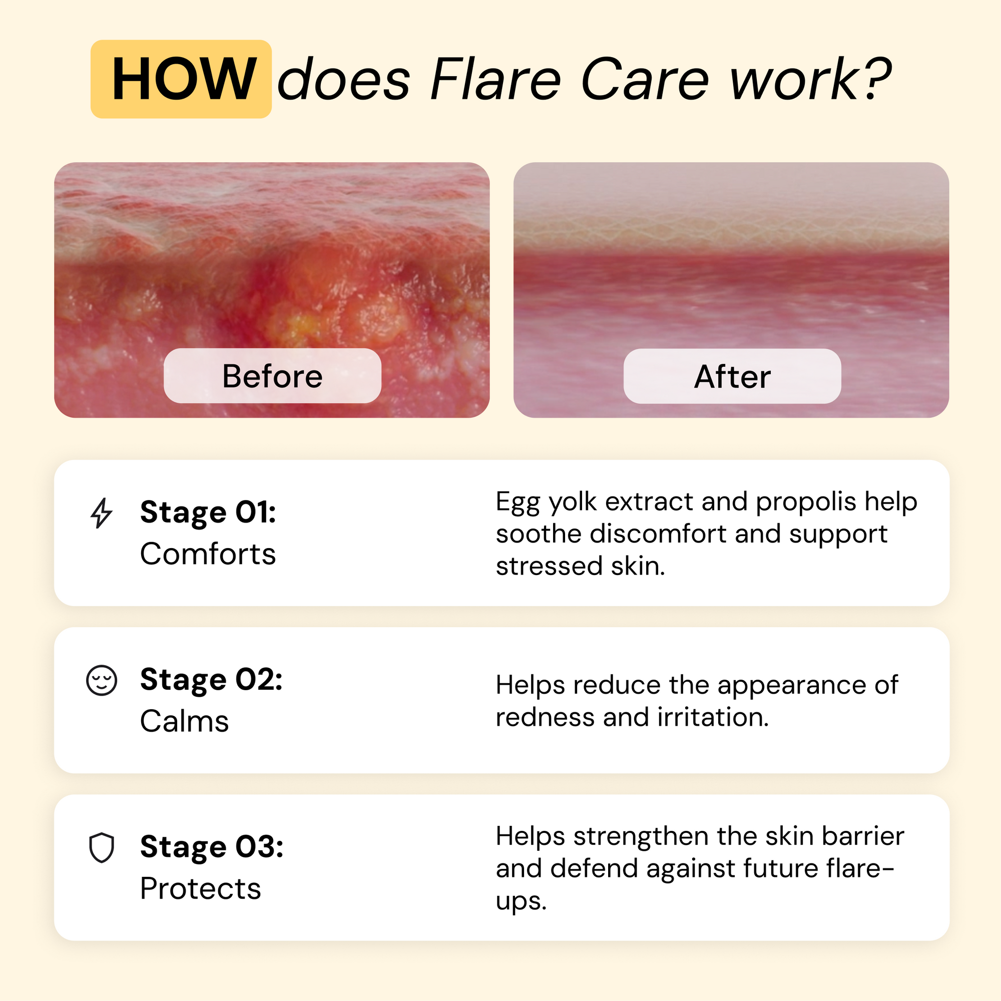 Any Flare-Ups, HS, Boils & Groin Cyst Solution | MyMagicHealer