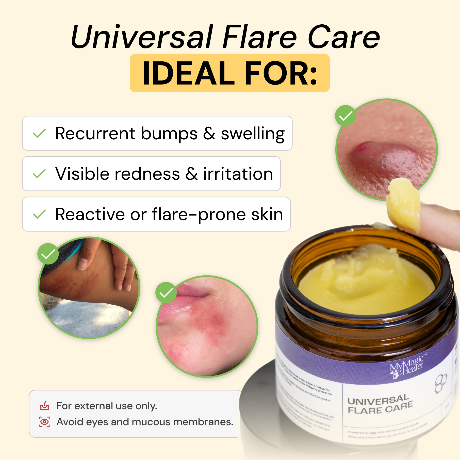 Any Flare-Ups, HS, Boils & Groin Cyst Solution | MyMagicHealer